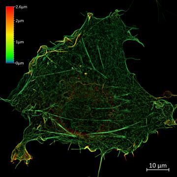 *New* Lattice SIM Family