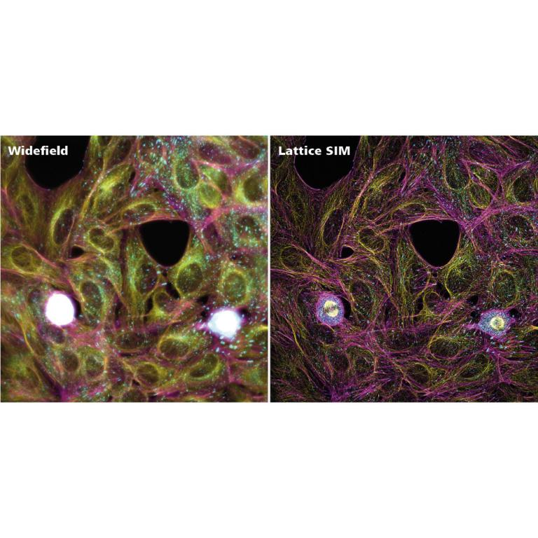 *New* Lattice SIM Family