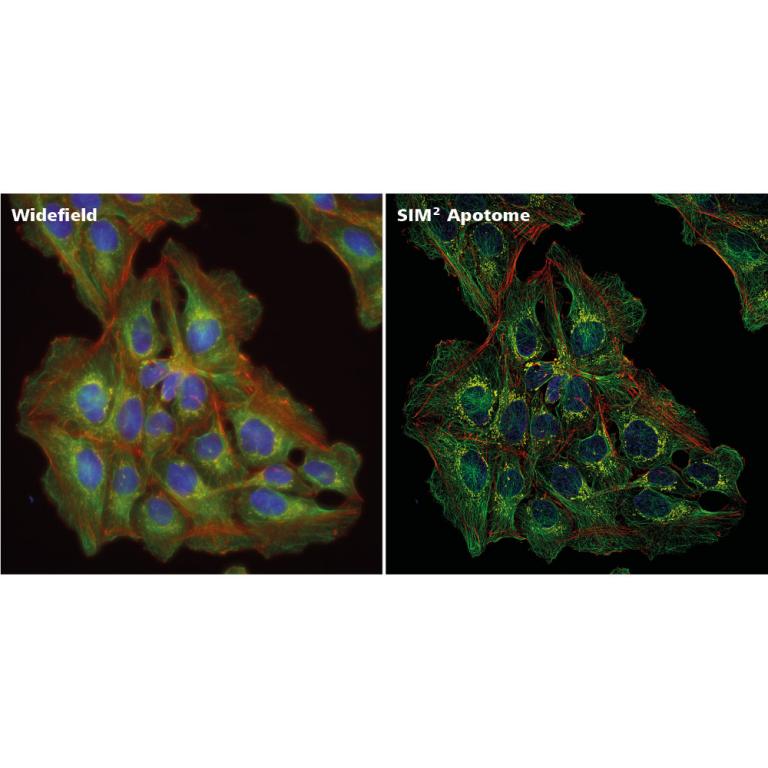 *New* Lattice SIM Family