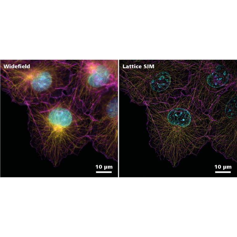 *New* Lattice SIM Family