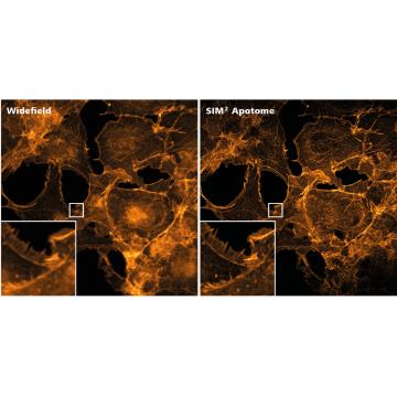 *New* Lattice SIM Family