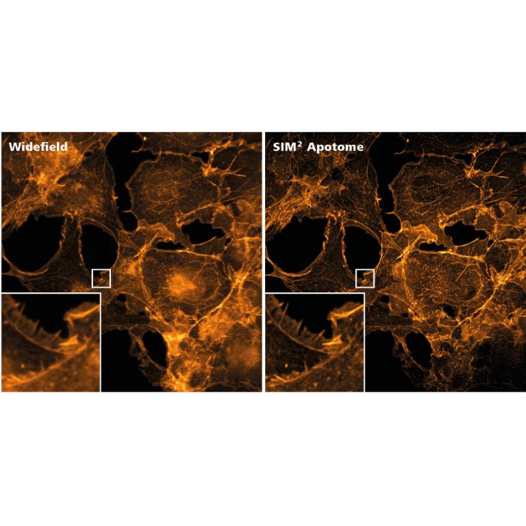 *New* Lattice SIM Family