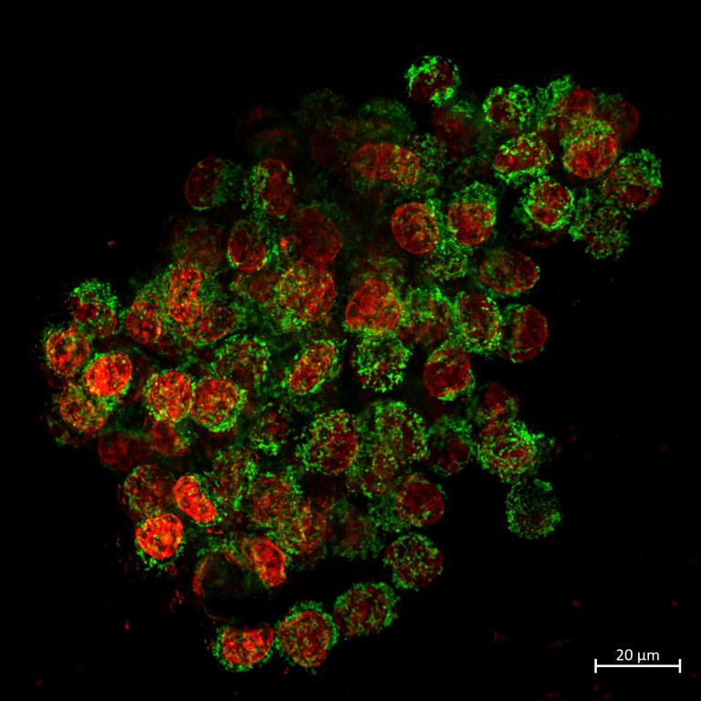 *New* Lattice SIM Family