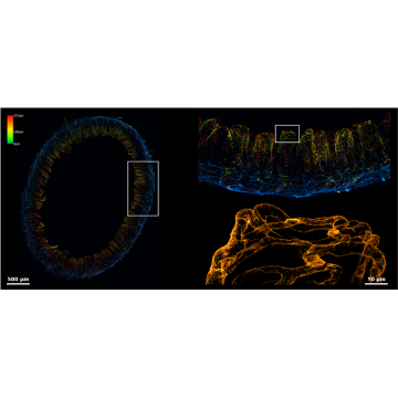 ZEISS Lattice SIM Family 런칭 웨비나