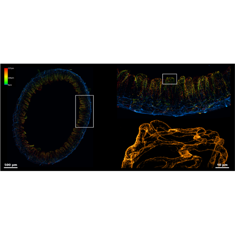 ZEISS Lattice SIM Family 런칭 웨비나